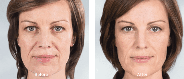 Miami Center for Cosmetic Dermatology – Dr. Deborah LongwillPerlane ...